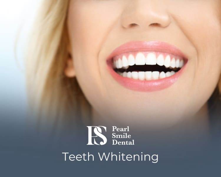 Pearl Smile Didsbury | Manchester | Dentist In Didsbury